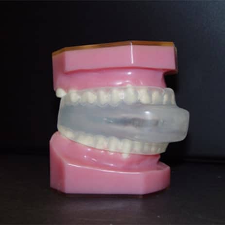 Sleep Apnea Oral Appliances Omaha, Nebraska